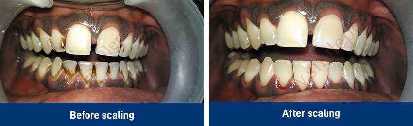 Dental Clinic in salem | Best Dental Hospital | Laser Dental Treatment ...